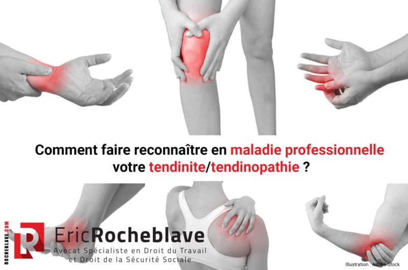 Comment faire reconnaître en maladie professionnelle votre tendinite ...